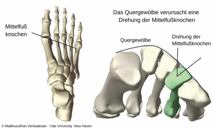 Fußfehlstellungen | Medizinische Fußpflege Kovac
